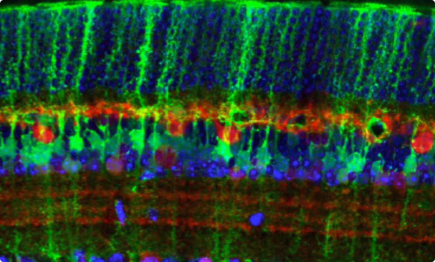 Gene Therapy - The Lowy Medical Research Institute : The Lowy Medical ...